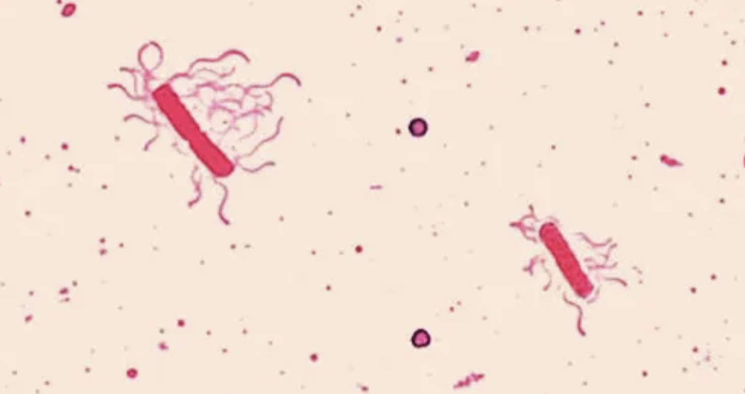 Microscopic Identification of Bacillus Cereus: Flagella Staining and Clinical Significance ...